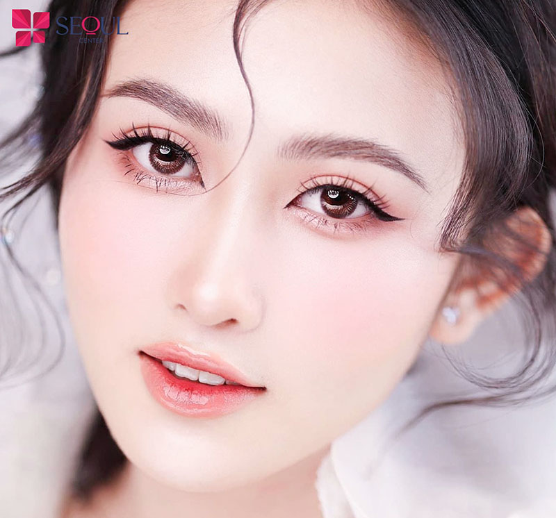 Tổng hợp các loại mí mắt của người Việt - Cắt Mắt Hai Mí