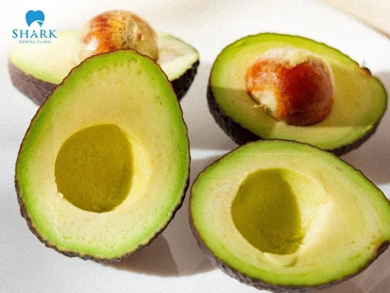 Can I eat Chipotle after wisdom teeth removal