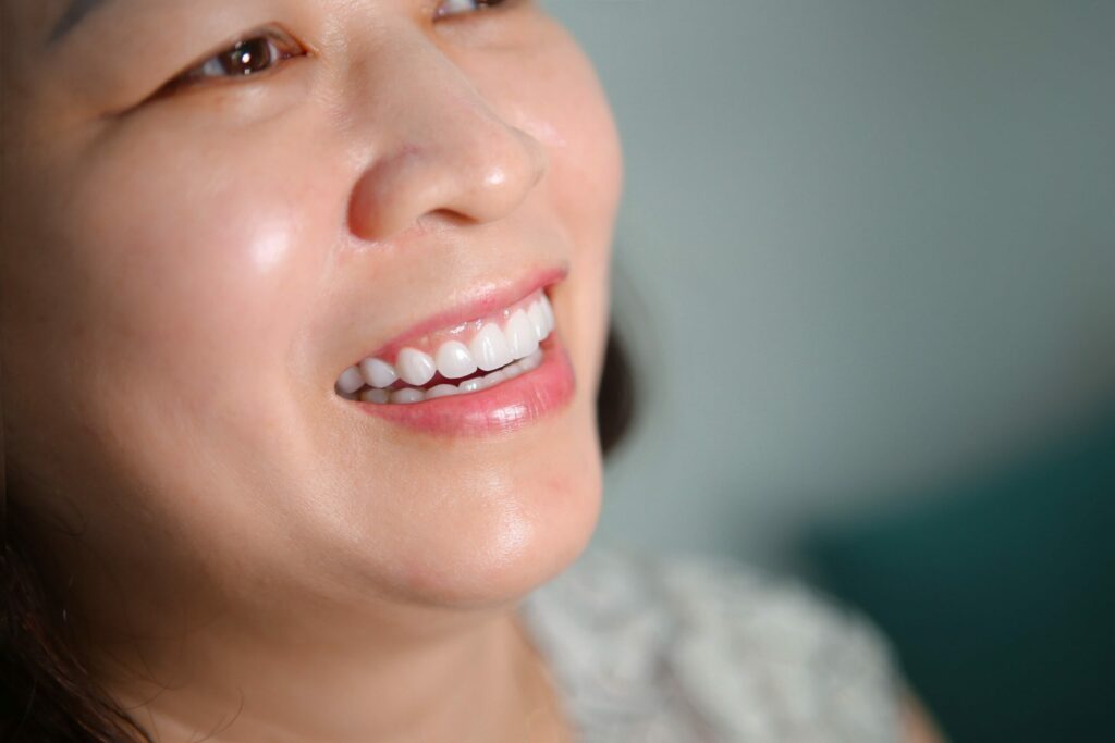 Hàm răng đẹp là như thế nào? 5 tiêu chí đánh giá răng đẹp