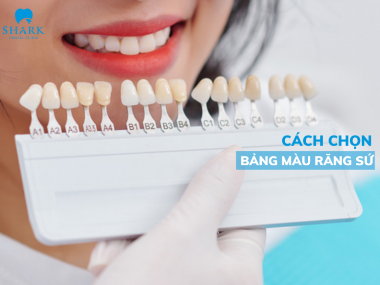 TOP 3 loại bảng màu răng sứ Vita được ưa chuộng hiện nay
