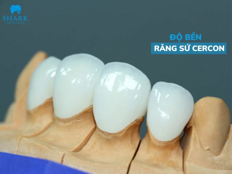 So sánh răng sứ Cercon HT và HT Smile loại nào tốt hơn?