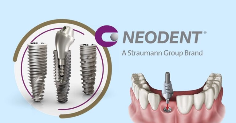 Trụ Implant Neodent của nước nào? Có tốt không?