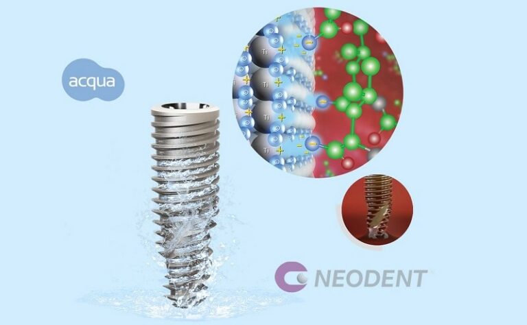 Trụ Implant Neodent của nước nào? Có tốt không?