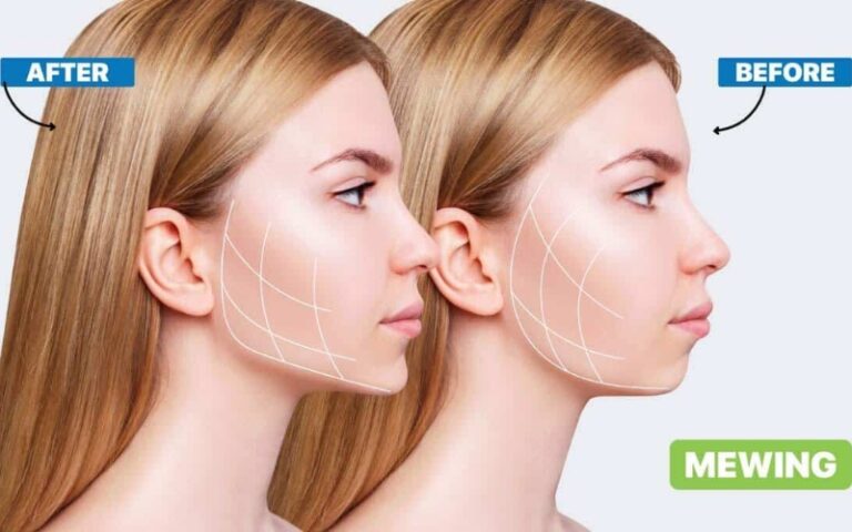 Mewing có giúp mặt hết lệch không? Cách mewing mặt lệch đúng