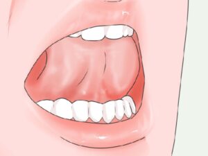 Mewing có giúp mặt hết lệch không? Cách mewing mặt lệch đúng