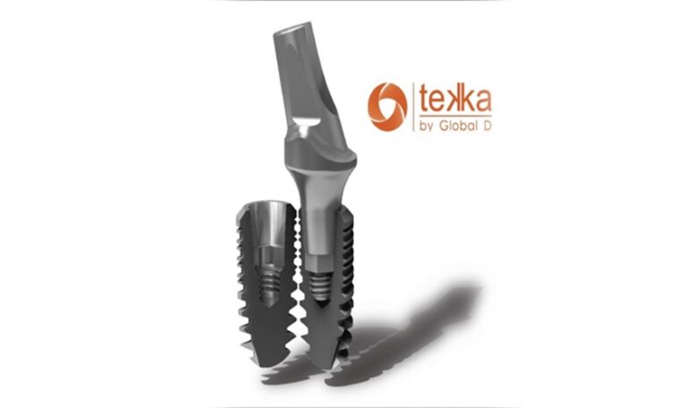Trụ Implant Tekka - Nha Khoa Lavener Dental