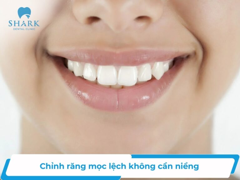 Dây cung niềng răng đâm vào má do đâu? Cách xử lý hiệu quả