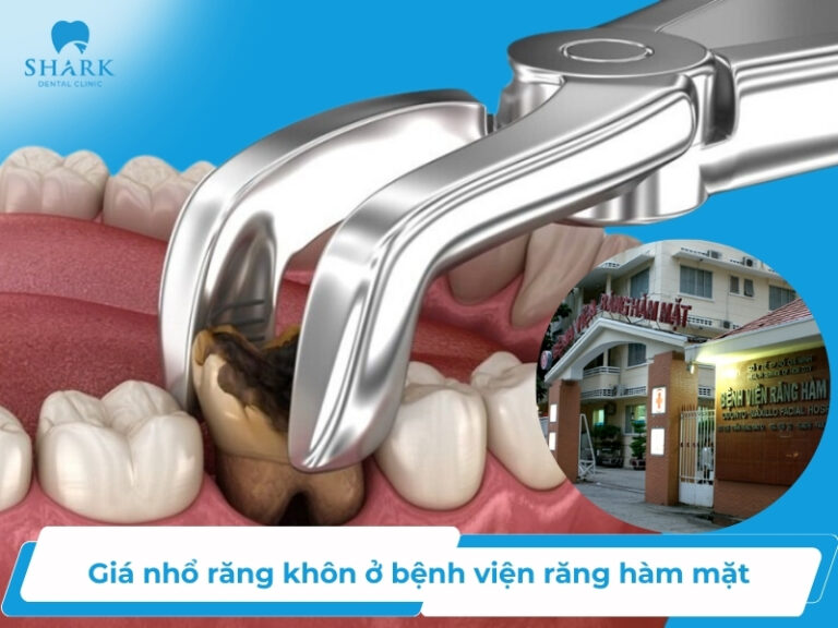 Review giá nhổ răng khôn bệnh viện Răng Hàm Mặt TP.HCM