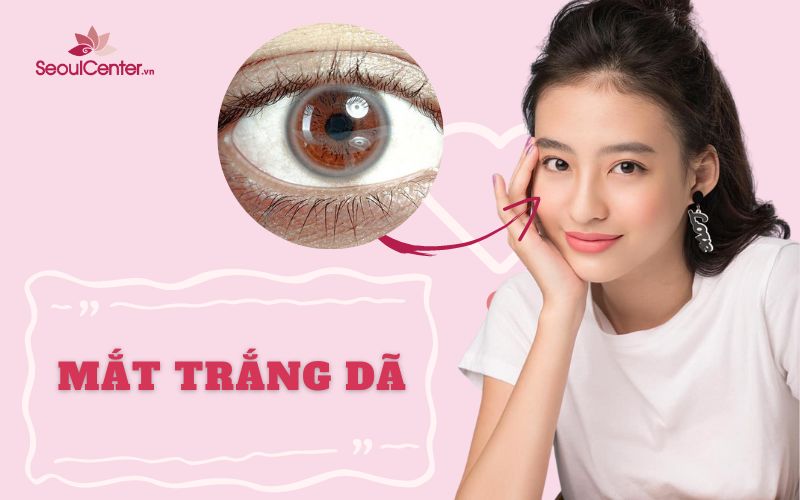 Mắt trắng dã là như thế nào? Tướng số tốt hay xấu ở nam nữ?