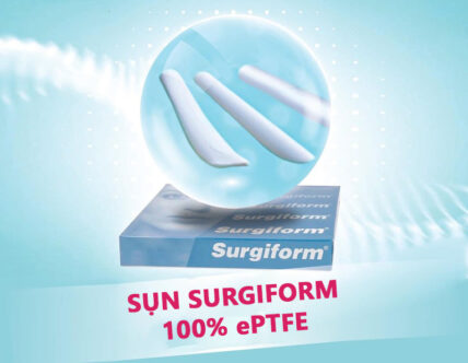 Nâng mũi Surgiform là gì? Ưu điểm của nâng mũi bằng sụn surgiform