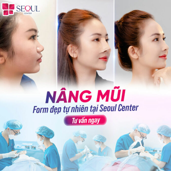 Nâng mũi sụn sườn và những điều bạn cần biết