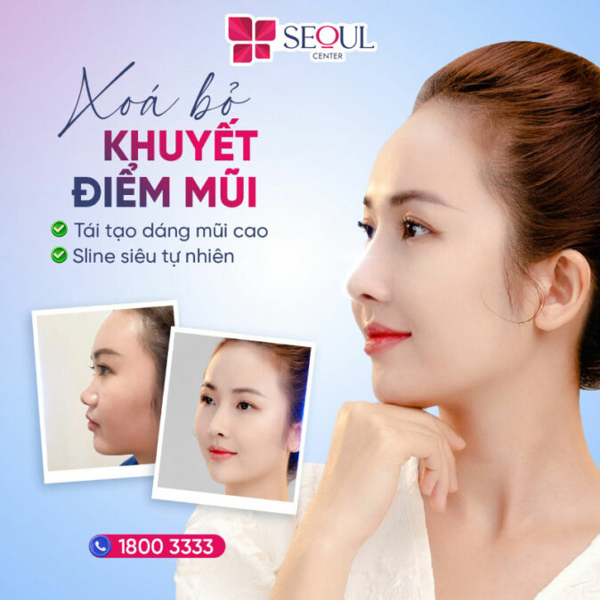 Nâng mũi sụn sườn và những điều bạn cần biết