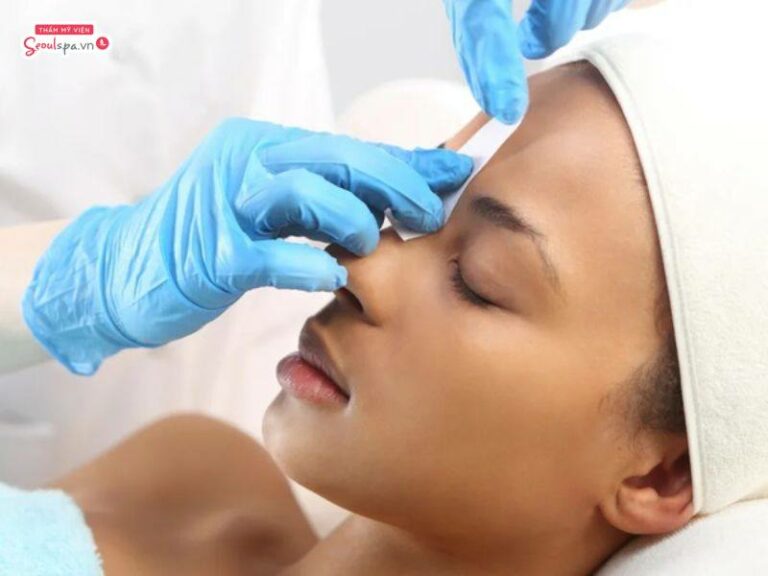 Triệt tóc trán là gì? Triệt đường chân tóc có giá bao nhiêu tiền?