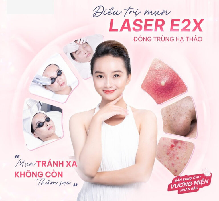 Top 7 địa chỉ spa trị mụn Long Khánh Đồng Nai uy tín bạn nên biết