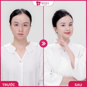 Top 7 địa chỉ spa trị mụn Long Khánh Đồng Nai uy tín bạn nên biết